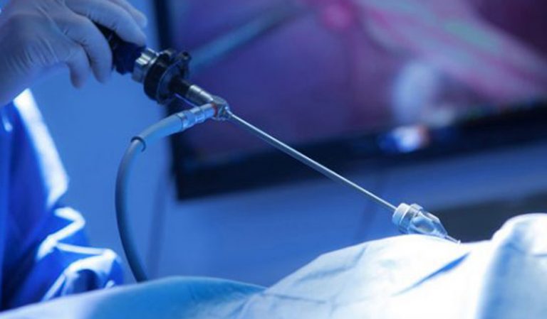 Laparoscopy – Miona Davidovich